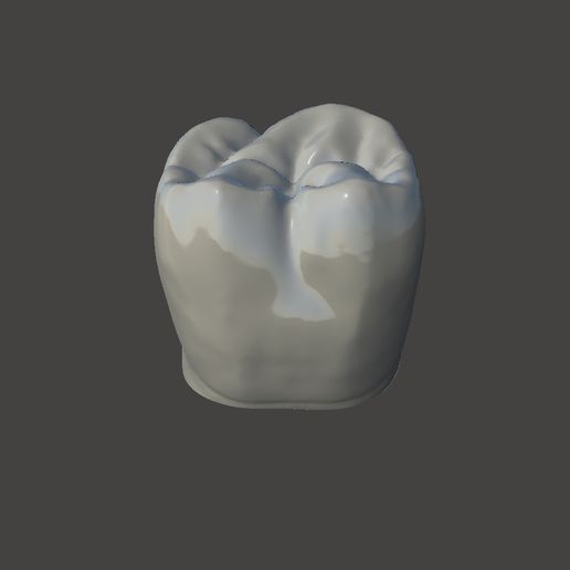 ⚕️ Second MOLAR SUPERIOR - 3D Design・ STL File for 3D printing and CNC ...
