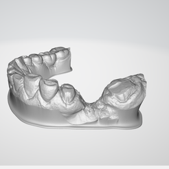 STL file Dental Surgical implant Guide With Model・Template to download ...