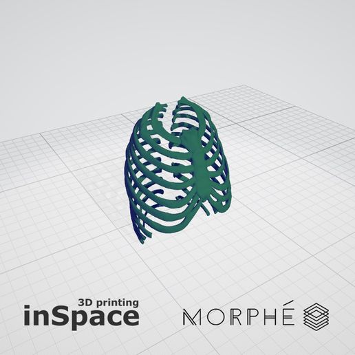 ⚕️ Medical - Ribs and rib cage (solid) - Real size・ STL File for 3D ...