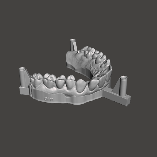 🫀 Anatomical Dental Model – Upper and Lower Jaw in Occlusion (STL)・Free ...