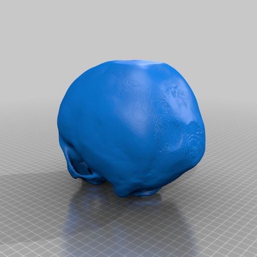 Free 3D file Skull from CT Scan 💀 ・Model to download and 3D print・Cults