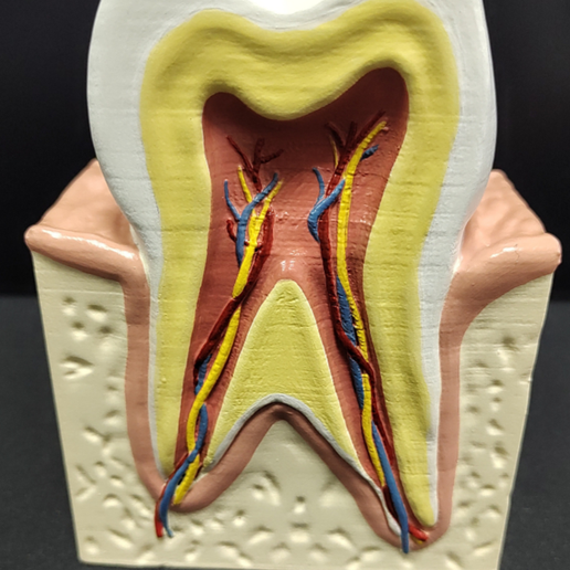 🦷 Applied molar tooth・ STL File for 3D printing・Cults