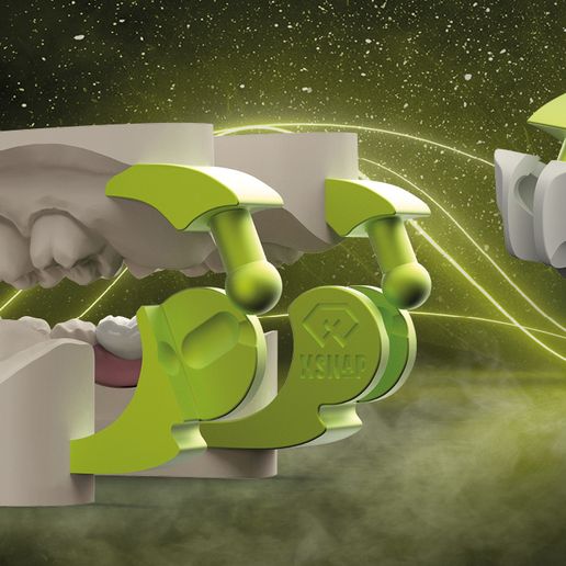 3D file Xsnap ARTICULATOR 2.0 TDM 🦷 ・3D printing model to download・Cults