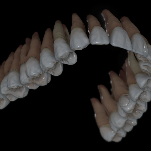 STL file Maxillary teeth 🦷 ・3D printer design to download・Cults