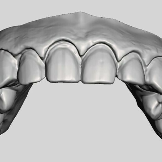 🦷 Veneers, model with preparation for veneers・Archivo STL para ・Cults