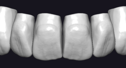 STL file Gebdi Tribos Exocad Tooth library 🦷 ・3D printing idea to ...
