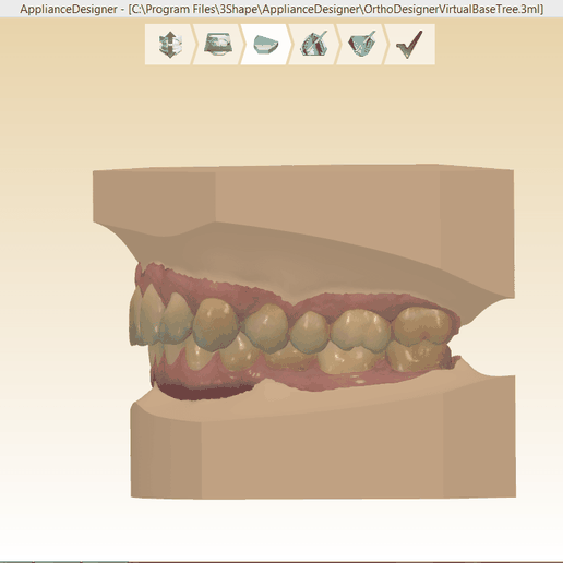 STL file Digital Orthodontic Study Models with Virtual Bases 🧑‍🏫 (OBJ ...