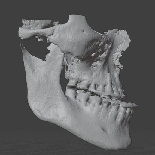 STL file Maxilla and Mandible 🩺 ・3D printable design to download・Cults