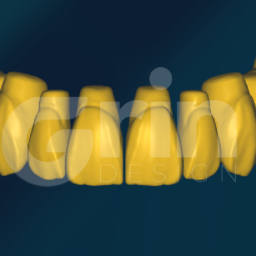 STL file GRIN DESIGN 2024 New Exocad Tooth library 🆕 ・Model to download ...