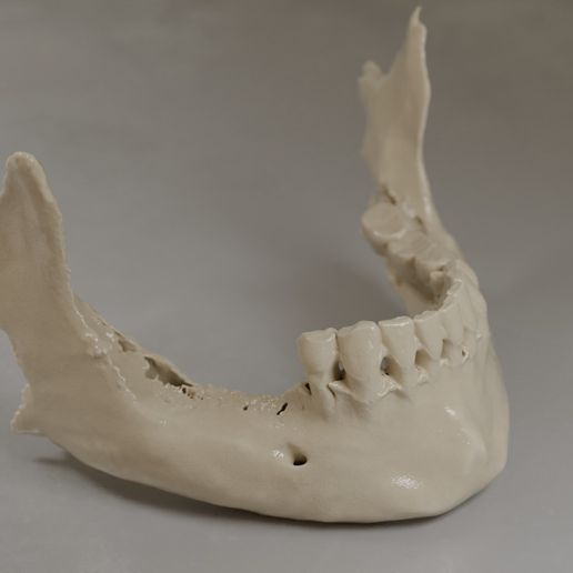 🫀 Anatomical Mandible – CBCT Reconstruction STL・ STL File for 3D ...