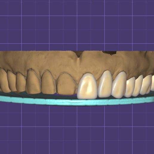 Fichier STL gratuit Alignment Plate for Exocad 🧰 ・Design pour ...