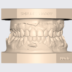 Dental best free STL files for 3D printer・560 models to download・Cults
