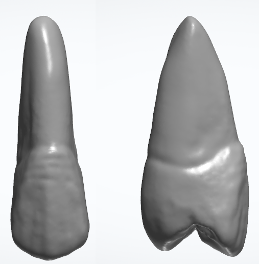 Anatomía Del Premolar Maxilar Elevación Del Piso Del Seno Máxilar