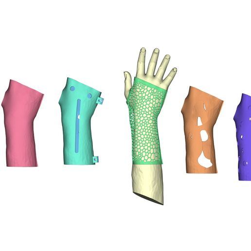 Hand splints・ STL File for 3D printing・Cults