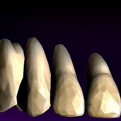 🧞‍♂️ exocad library grin 2025・ 3D File for 3D printing and CNC ...