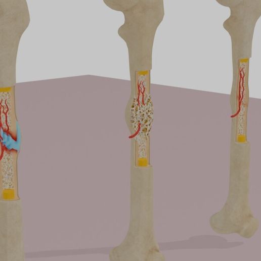 🦴 Human Long Bone Structure – Internal Anatomy & Healing Stages (3D ...