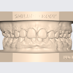 Dental best free STL files for 3D printer・560 models to download・Cults