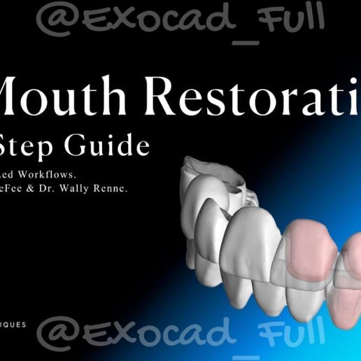 🦷 exocad-Full-Mouth-Restorations-Step-by-Step-Guide・ 3D File for 3D ...
