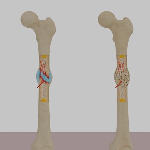 🦴 Human Long Bone Structure – Internal Anatomy & Healing Stages (3D ...