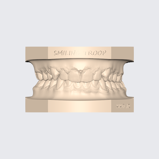 🦷 ARTICULATED UPPER AND LOWER DENTAL MODEL (22)・Free STL File for 3D ...