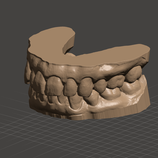 STL file Dental Demo Model_Upper Maxilla_&_Lower Mandible_008 🦷 ・3D ...