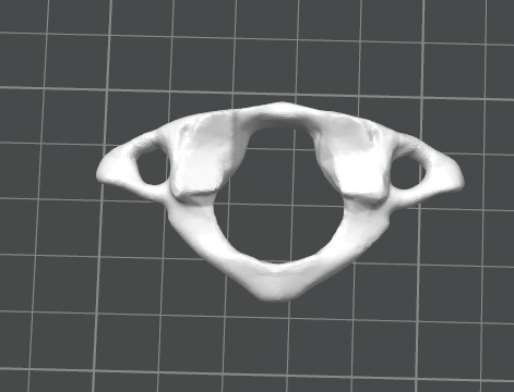 🫀 Atlas Vertebra (C1) - Anatomical 3D Model・ STL File for 3D printing・Cults