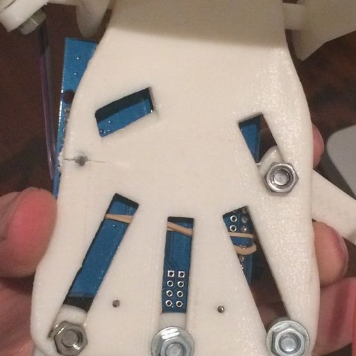 🤲 3D Printed Powered Exoskeleton Hands (Upgrade v2)・Free STL File for ...