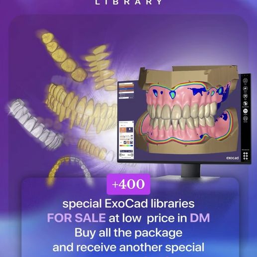 Archivo 3D +400 biblioteca exocad 🩻 ・Plan de impresora 3D para ...