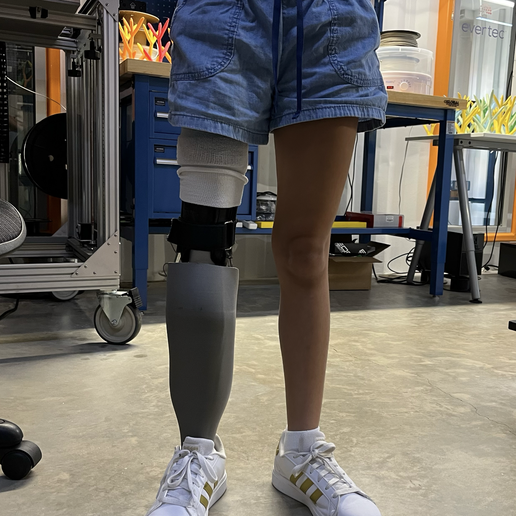 🦵 Rotationplasty Prosthetic Leg Cover DEMO v1・Free OBJ File for 3D ...