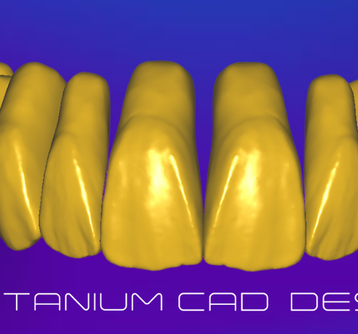 Archivo STL TITANIUM CAD Exocad Tooth library 🦷 ・Objeto imprimible en ...