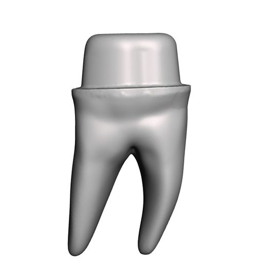 STL file first molar prepared for crown 👑 ・3D printable model to ...