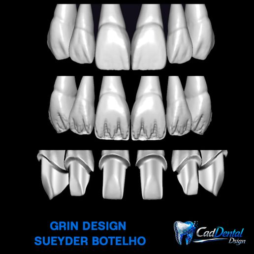 🦷 GRIN DESIGN LIBRERIA COMPLETA / GRIN DESIGN FULL LIBRARY・ 3D File for ...