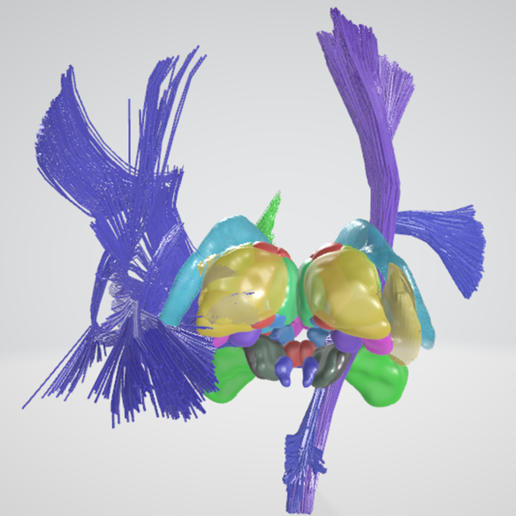 STL file Thalamus Nuclei, Basal Ganglia and Motor pathway,Visual ...