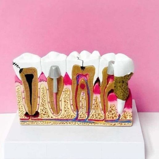 🦷 Model of dental endodontics・ STL File for 3D printing・Cults