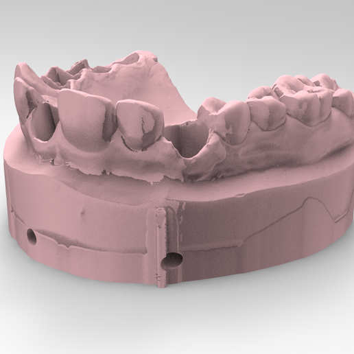 🦷 Prosthodontic Training Model – Maxilla & Mandible with Segmented ...