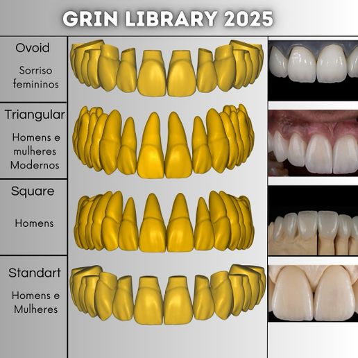 STL file GRIN DESIGN 2025 NEW Exocad Tooth library 🆕 ・Model to download ...