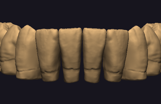 🧞‍♂️ teeth libraries・ STL File for 3D printing・Cults