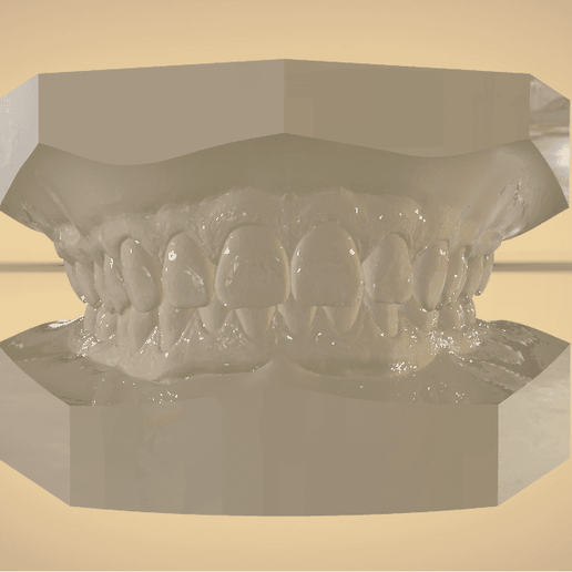 STL file Digital Orthodontic Study Models with Virtual Bases 🧑‍🏫 (OBJ ...