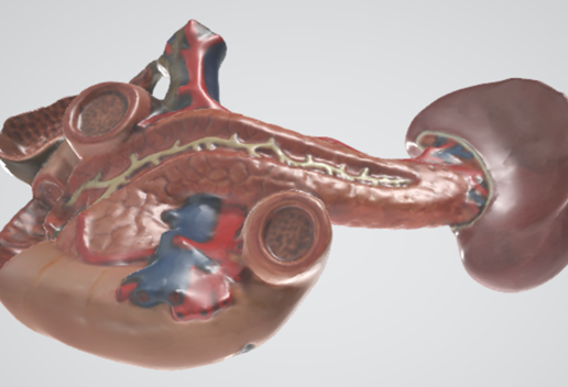 🩻 Scan Life-size Pancreas, Duodenum, Gallbladder & Spleen 3D Model with ...