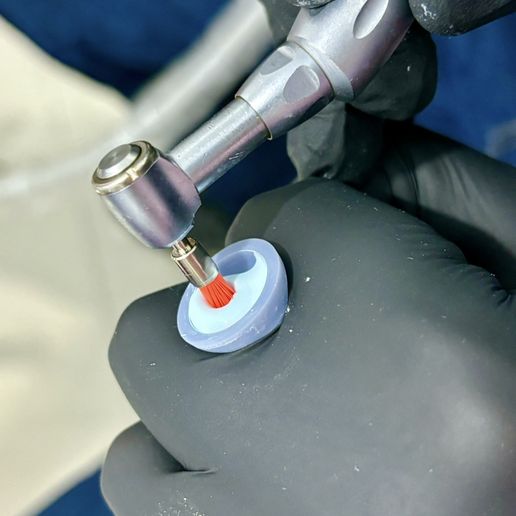 STL file PORTA PASTA DE PASTA DE PROFILAXIS DENTAL / DENTAL PROPHYLAXIS ...