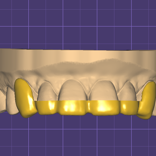 🦷 Grillz teeth gold cut front・ STL File for 3D printing・Cults