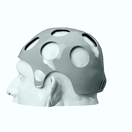 🪖 Custom Helmet For Post Cranioplasty・ STL File for 3D printing・Cults