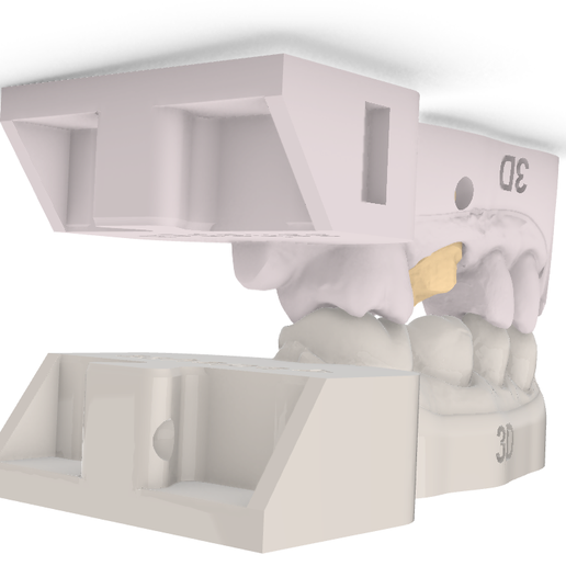 🩻 Digital Quadrant Model with 3Shape Articulator Interfaces・ STL File ...