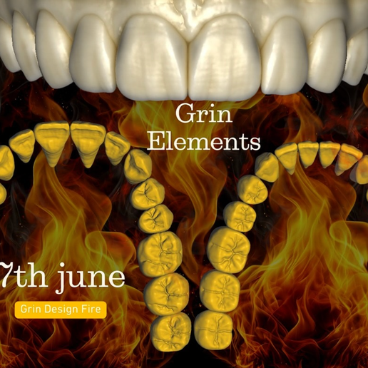 Archivo 3D exocad library grin 2025 🆓 ・Modelo para descargar y imprimir ...