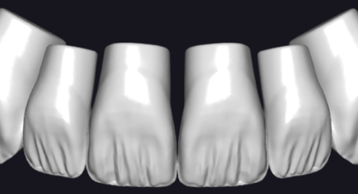 🦷 PDL FULL LIBRARY 2025・ 3D File for 3D printing, CNC machining - Laser ...