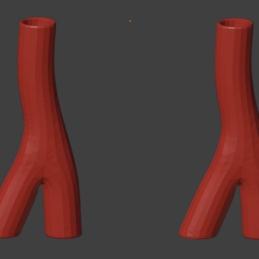 🧪 3D Model of Peripheral Artery Disease・ STL File for 3D printing・Cults