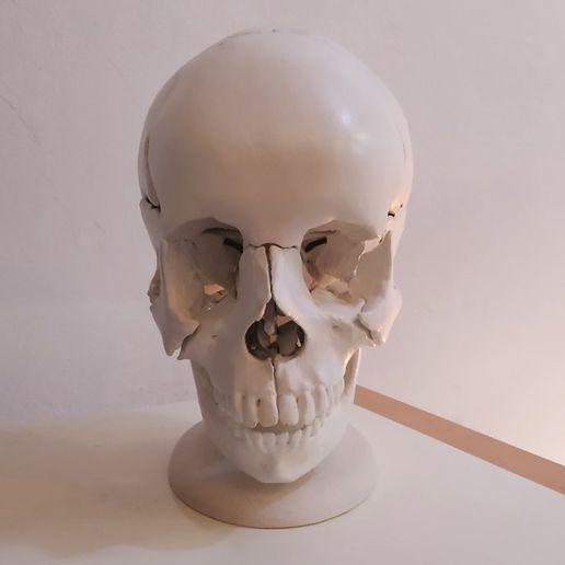 💀 Real Human Skull for Medicine - Real Human Skull for medicine ...