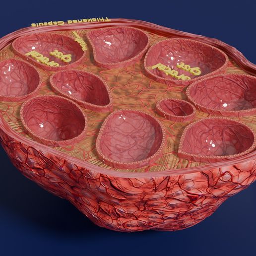 ⚕️ Polycystic Ovary Disease PCOD・ STL File for 3D printing・Cults