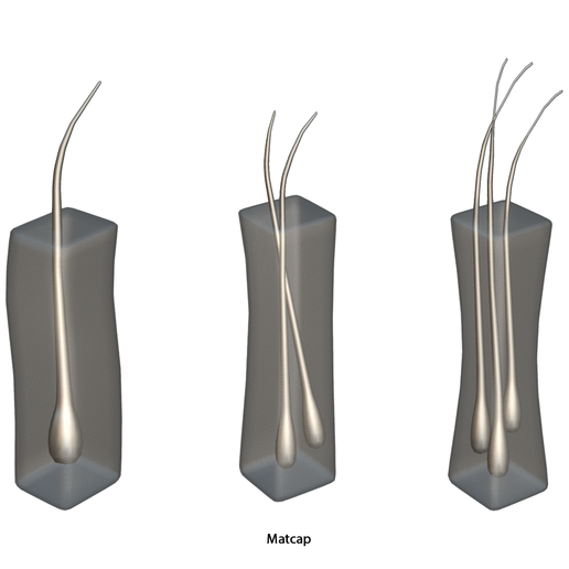 💇 Grafts With Different Hair Count・ 3D File for ・Cults