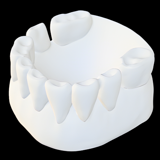 🩻 Single Maxillary Dental Arch Model・ STL File for 3D printing・Cults